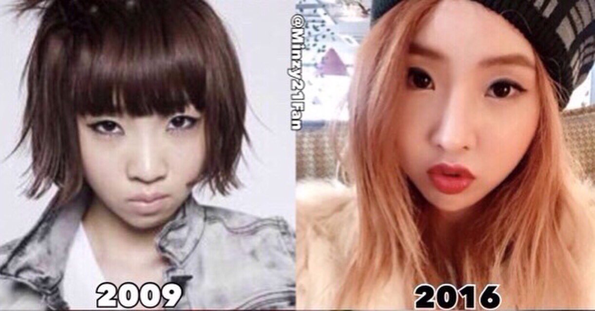 2ne1 Minzy Nose Job Before And After