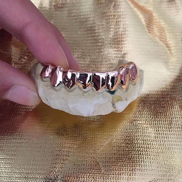 Rose Gold Teeth