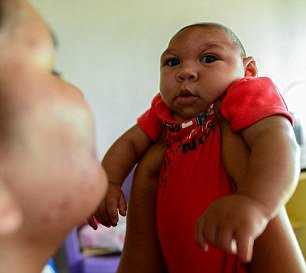 Zika babies with small heads will be DUMPED in orphanages, Brazil warns ...