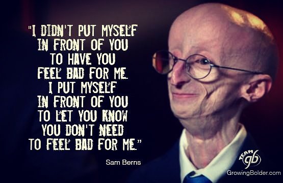 Sam Berns Progeria