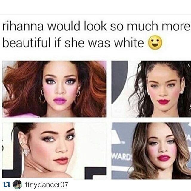 Rihanna Before And After Bleaching