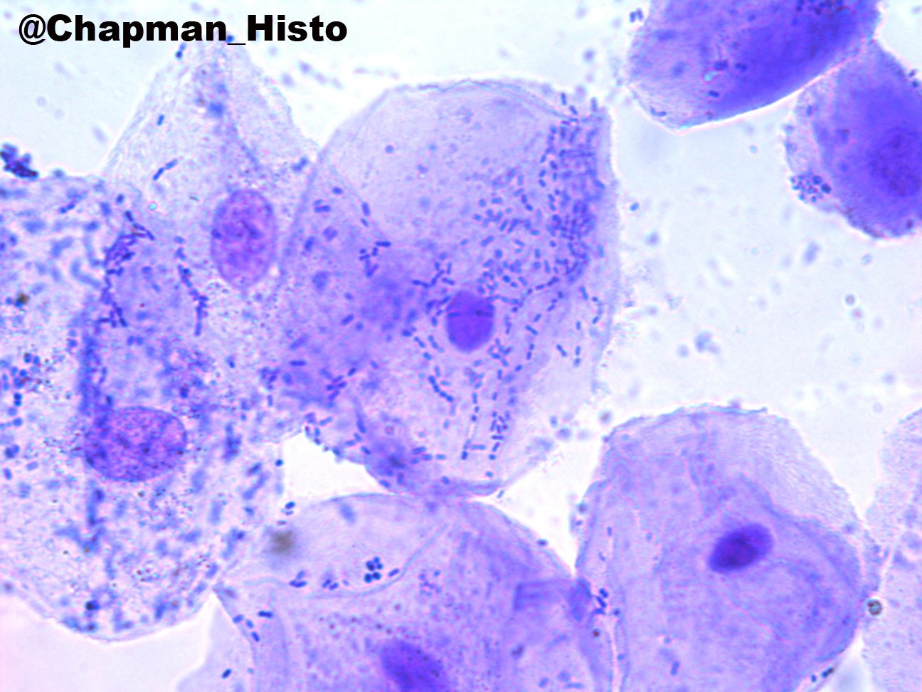 Cheek Cells Under A Microscope