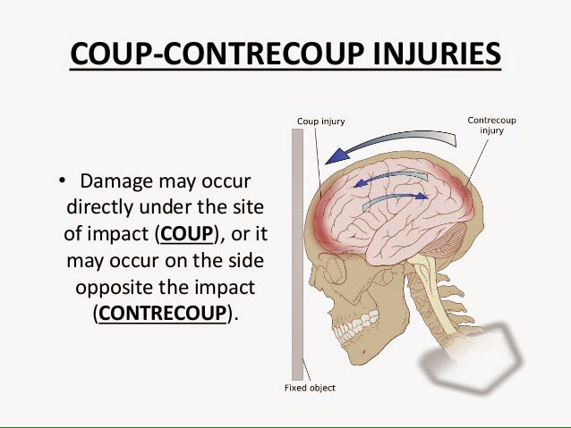 Coup Contrecoup Injury Symptoms