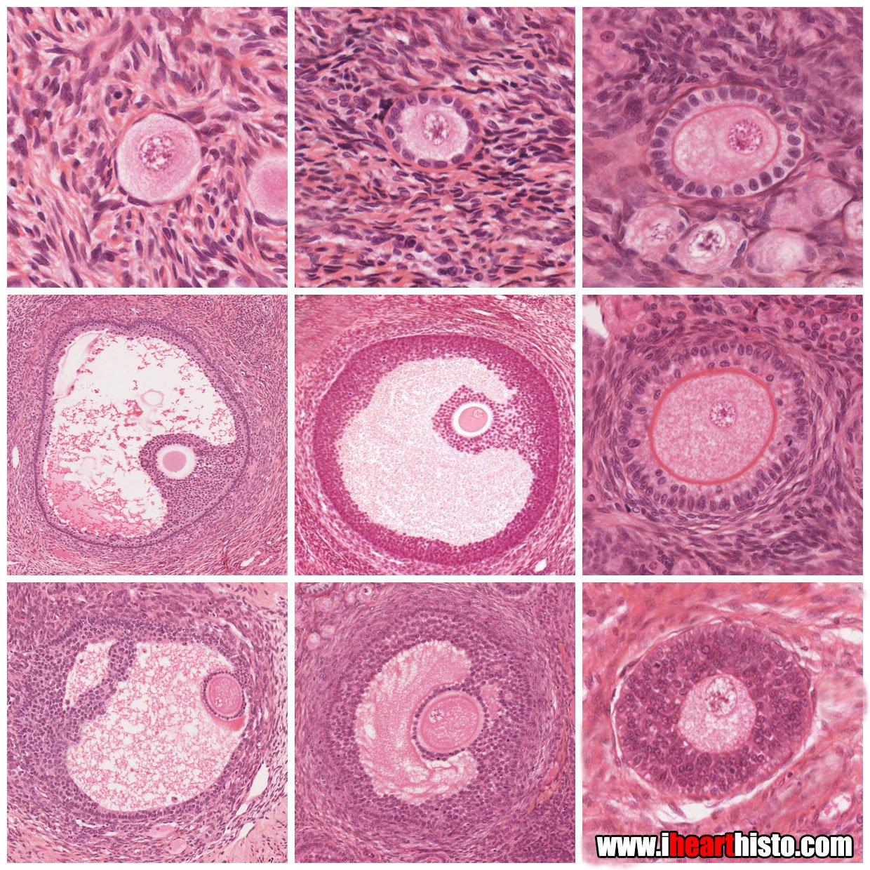 Ovary Slide Labeled Ovum