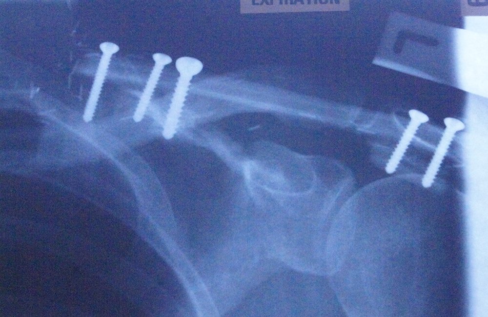 Carol Loughton's injuries from Port Arthur have been severe and ongoing ...