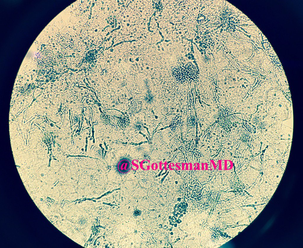 Spaghetti And Meatballs Appearance