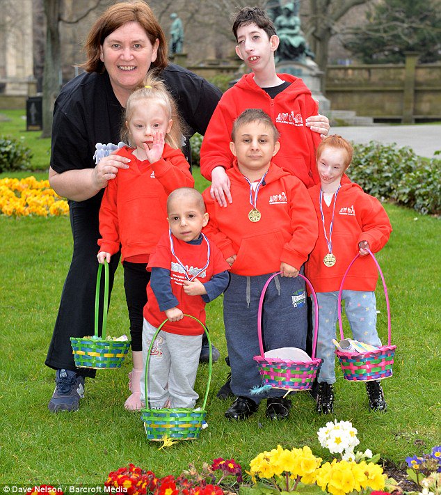 Children with rare form of dwarfism meet others with their condition ...