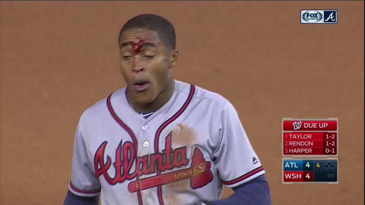 [ATL] 경기 못보고 있는데.. : MLBPARK