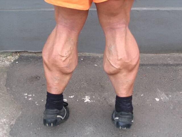 Small Calf Muscles