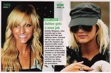 Ashlee Simpson Nose Job Before And After