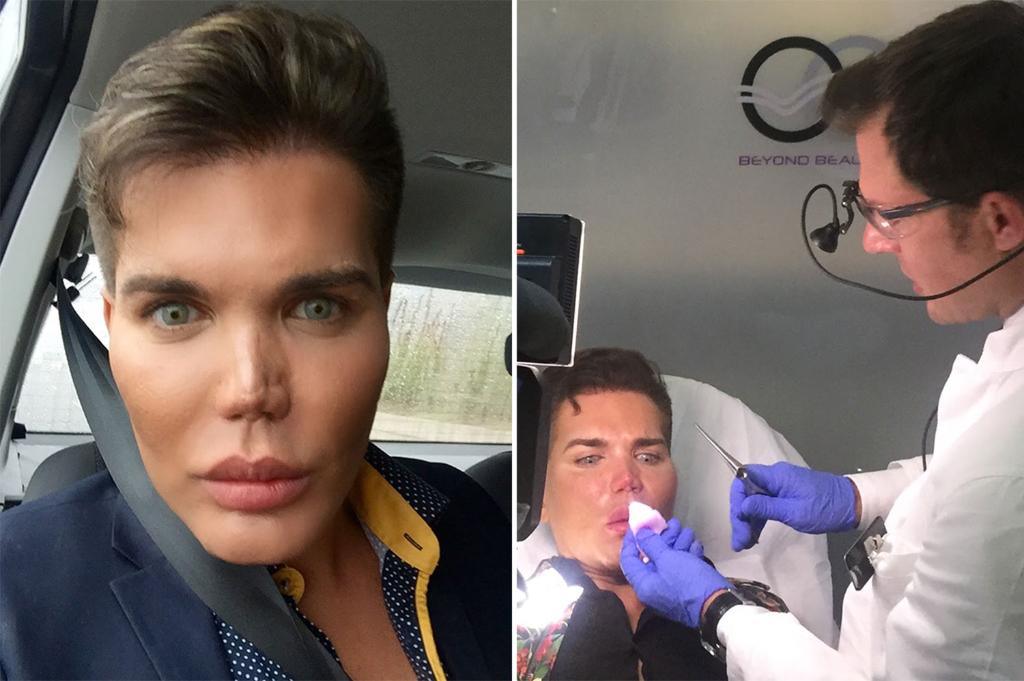 Real-life ‘Ken doll’ surgery addict will get a new £50,000 nos ...