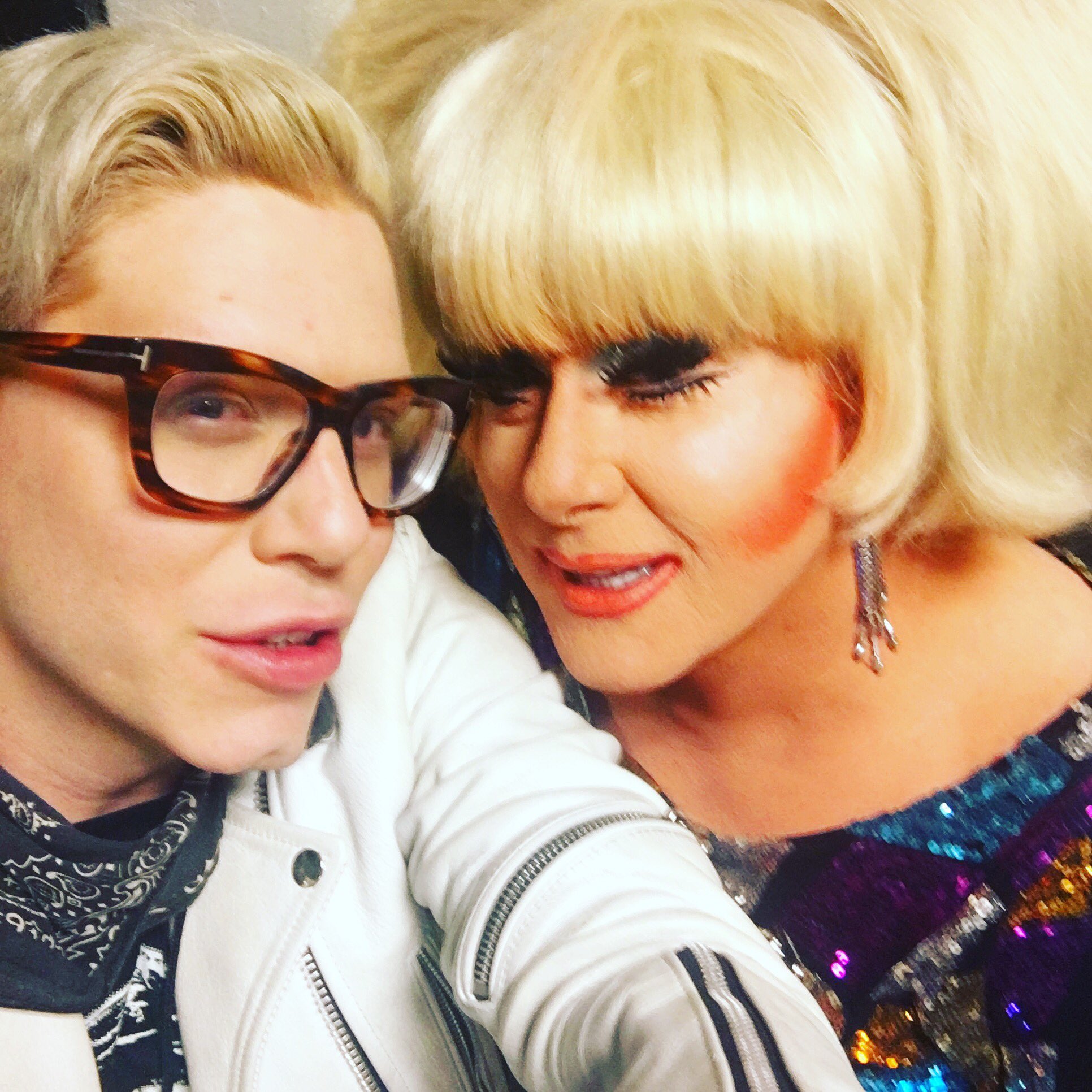 Sharon Needles Plastic Surgery