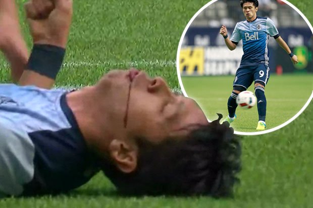 Watch: nightmare football accident leaves unconscious player spewing ...