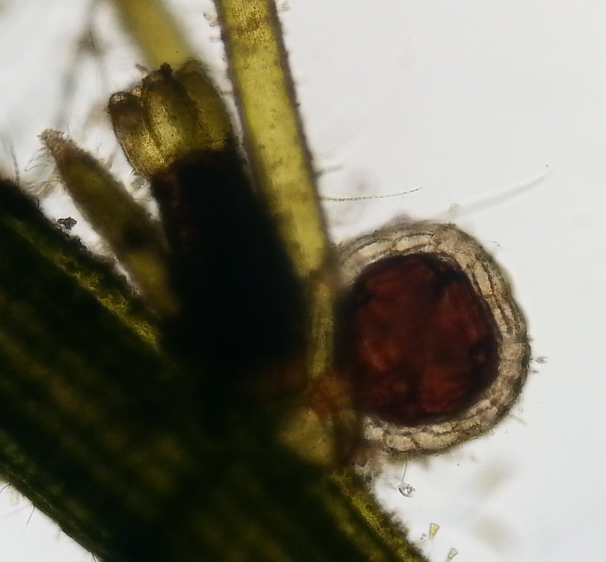 Chara Under Microscope