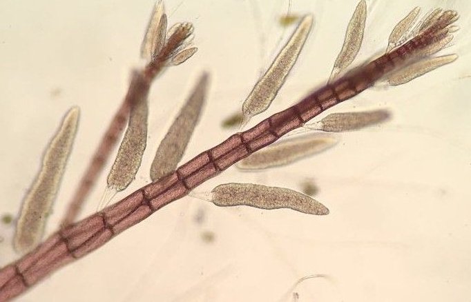 Polysiphonia Under Microscope