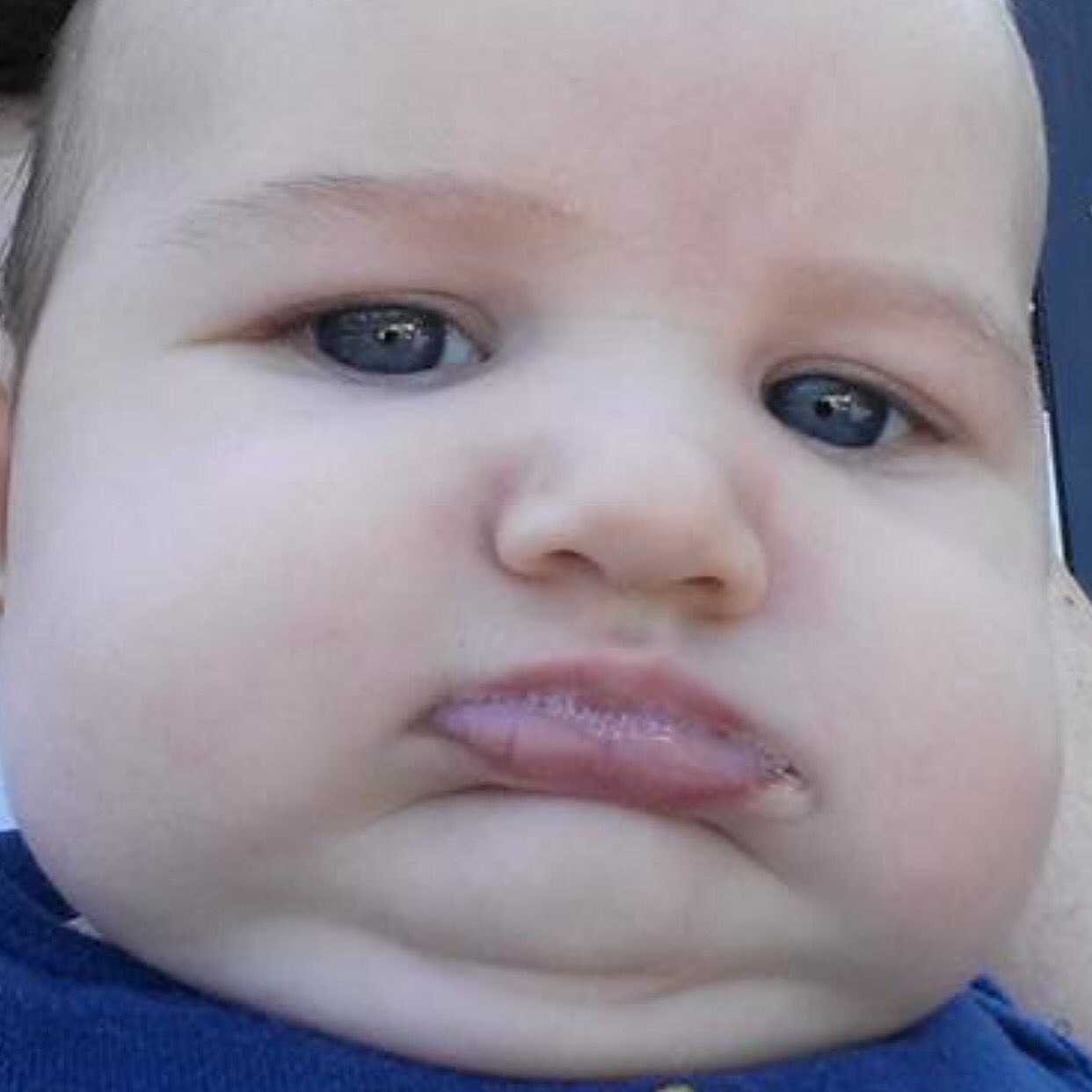 Fat Baby Face File:Child's Head, With Fat Cheeks; Profile. Drawing, C.