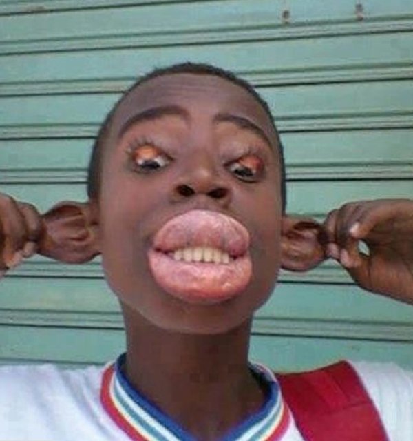 The Most Ugliest Boy In The World