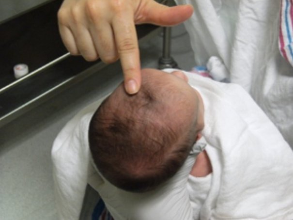 ¿por qué es tan importante la mollera del bebé? - scoopnest.com