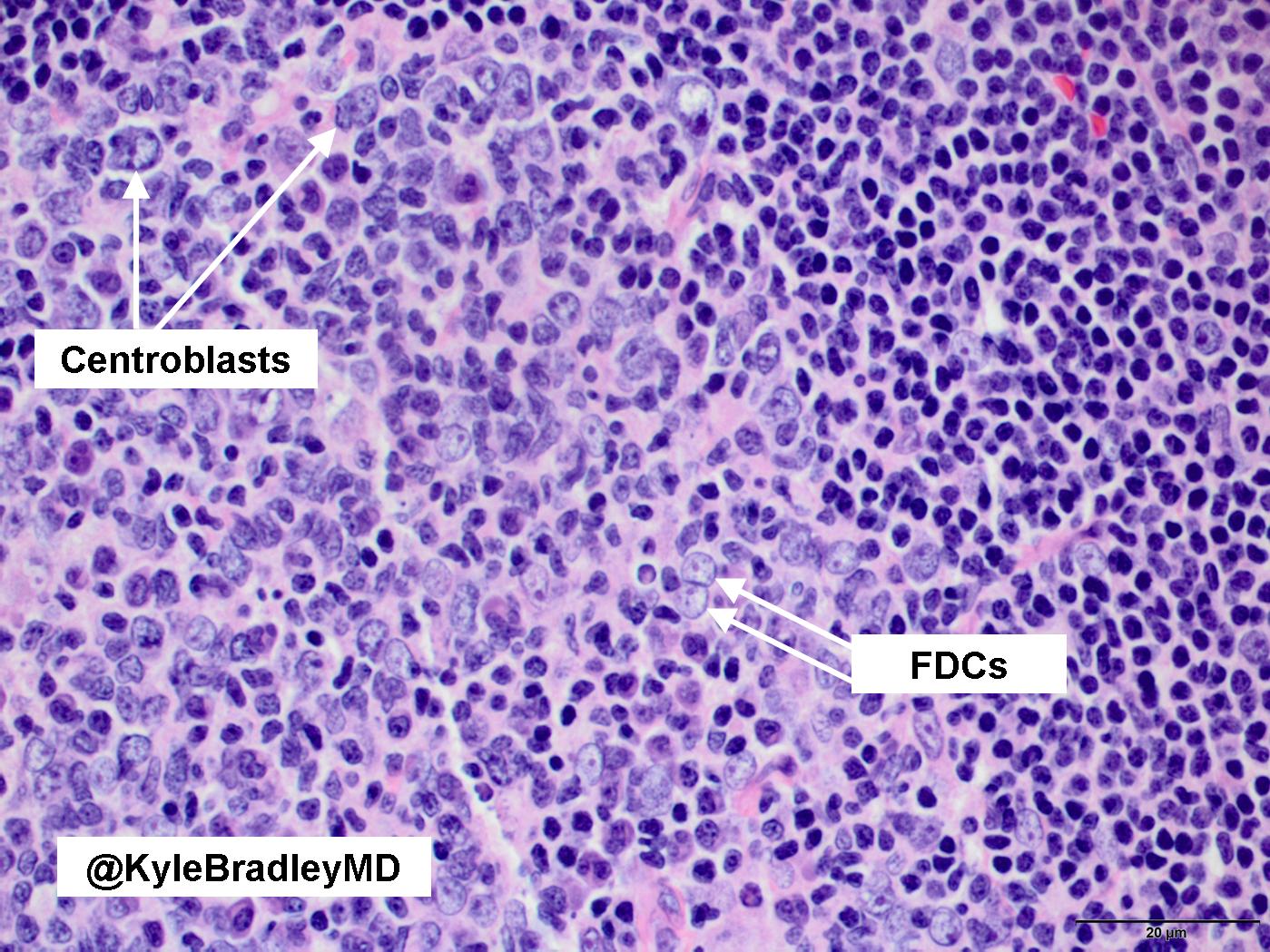 Dendritic Cells Histology