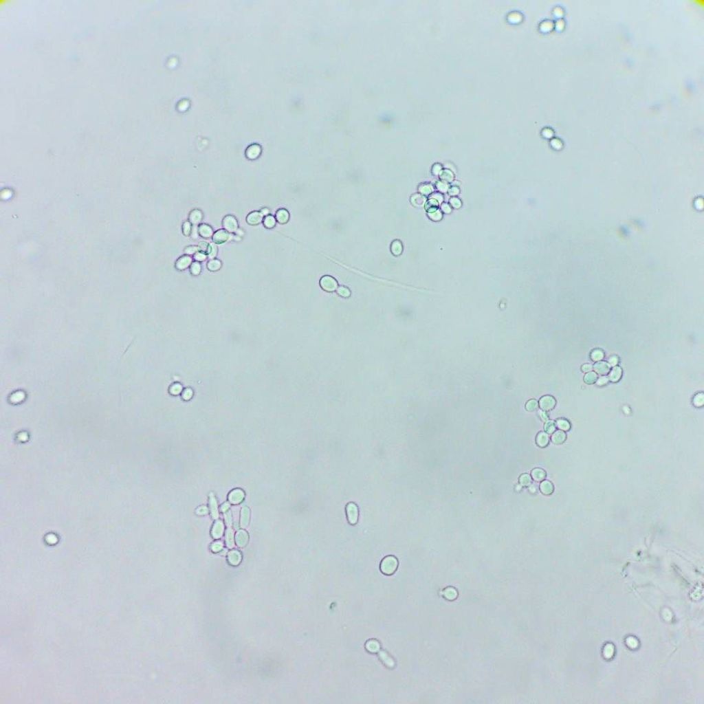 Candida Germ Tube