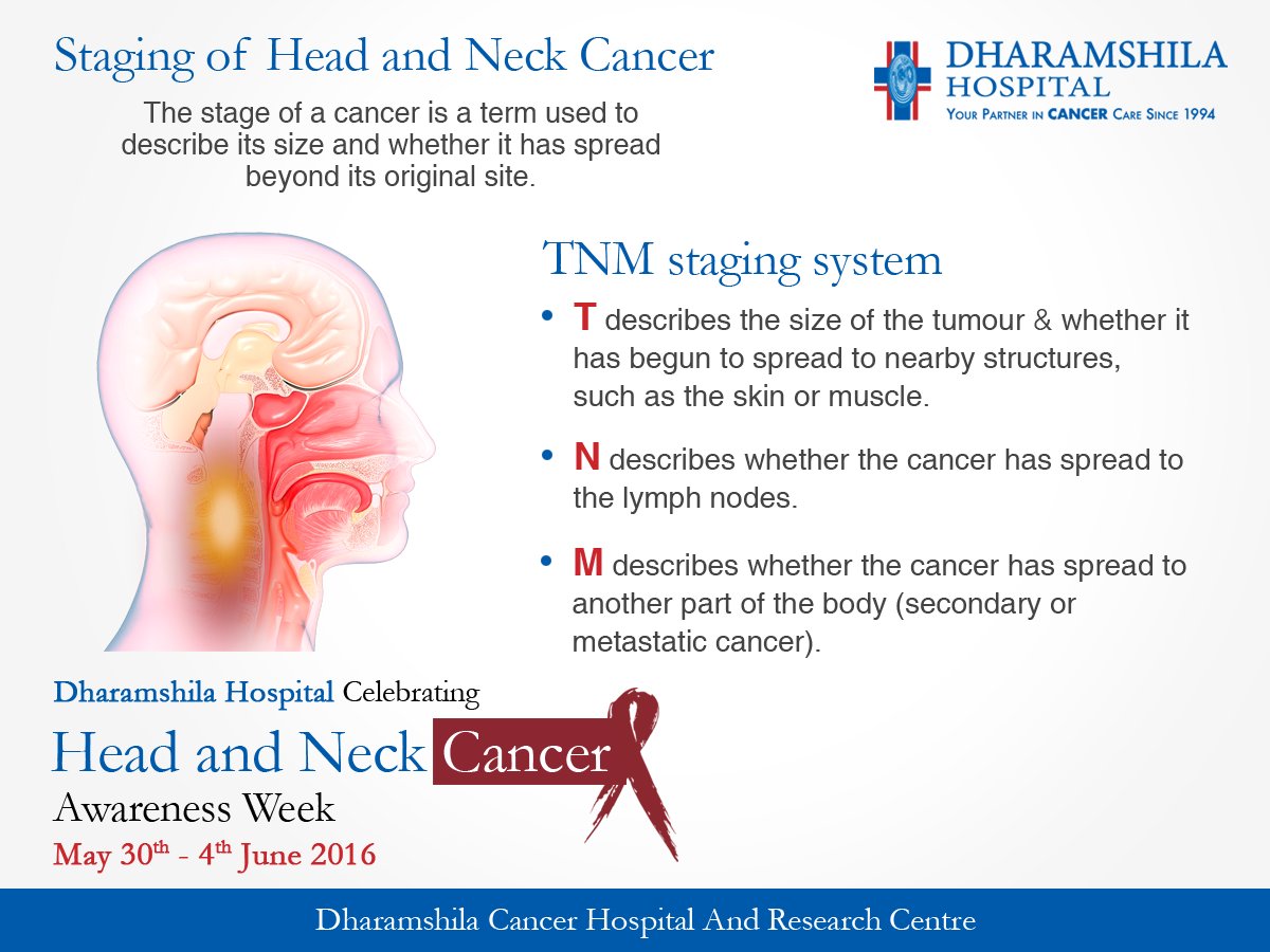 Neck Cancer Stages