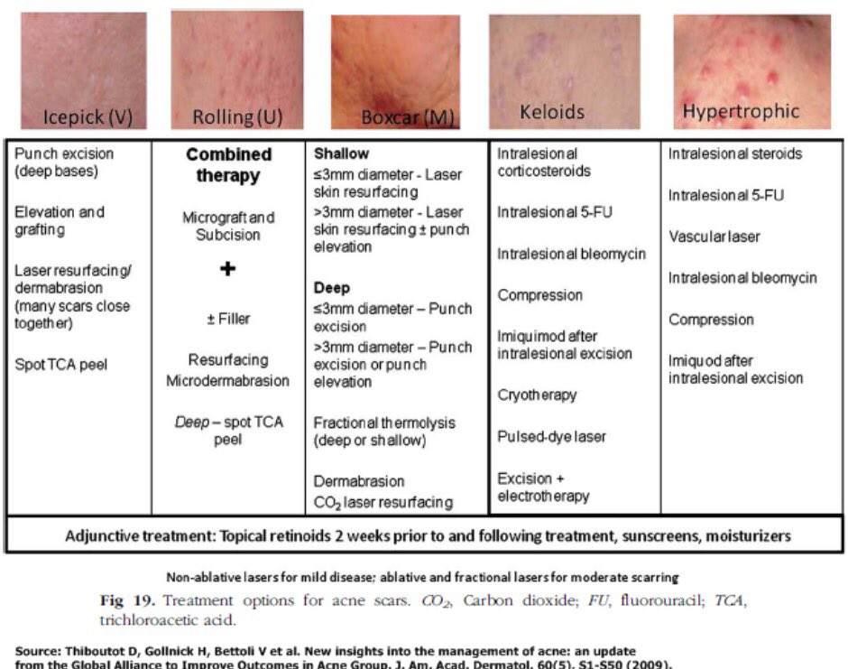 Navigating The Acne Treatment Landscape: A Comprehensive Guide To ... Navigating The Acne Treatment Landscape: A Comprehensive Guide To ...