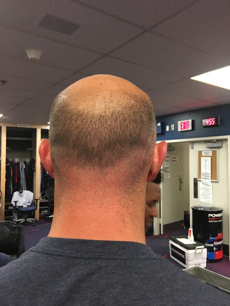 Buzz Cut Back Of Neck