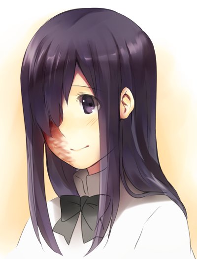 Katawa Shoujo Hanako Scars