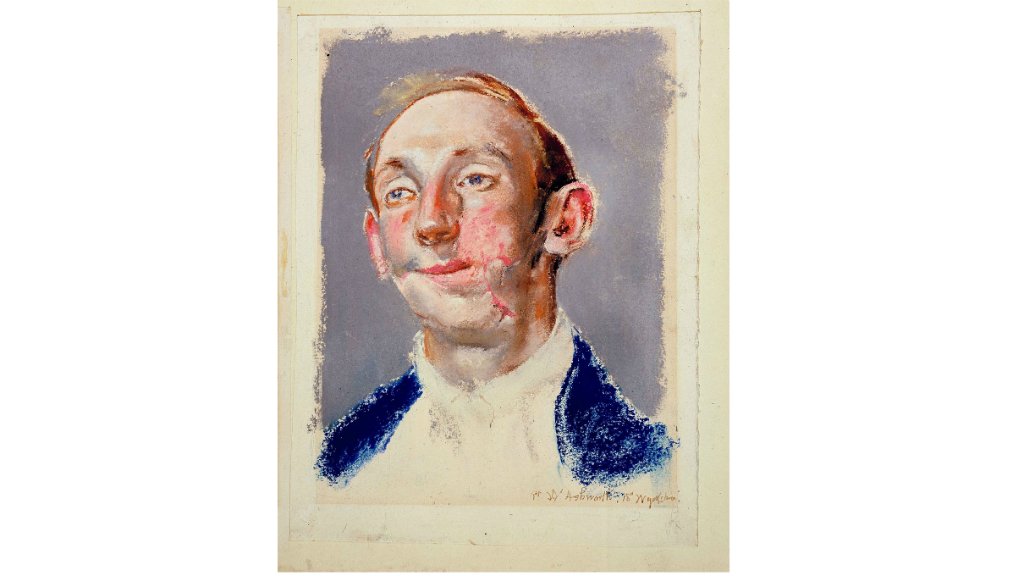 Henry Tonks made pastel images of facial wounds from WWI. Historian ...