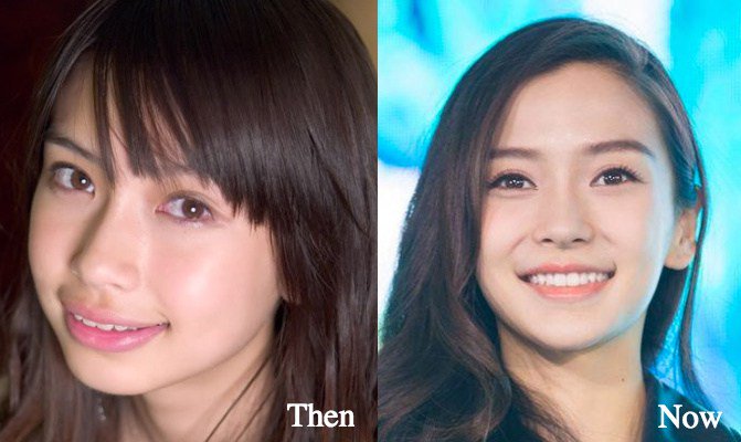 Angelababy Plastic Surgery