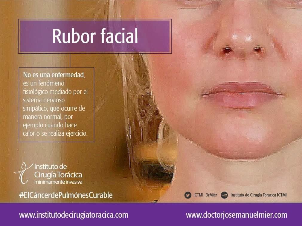 Viento Guante periódico rubor enfermedad telar guisante juego