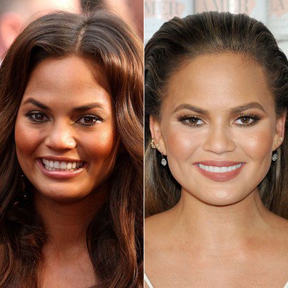 Celebrity Teeth: Before and After | British GLAMOUR | Scoopnest