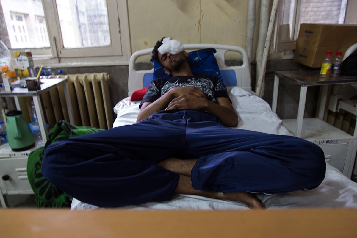 In Pictures: Pellet guns cause severe eye injuries in Kashmir by ...