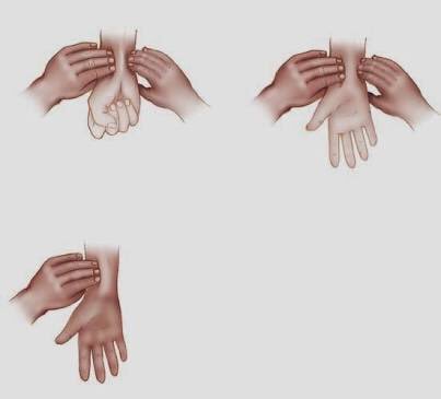 Bloc d´un Metge de Família: Pràctica clínica: Test d´Allen