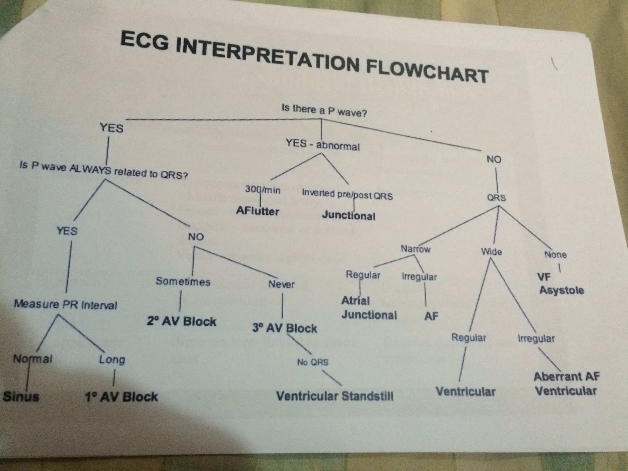 USMLE Step On X: Easy ECG Interpretation Flowchart #usmle, 54% OFF USMLE Step On X: Easy ECG Interpretation Flowchart #usmle, 54% OFF