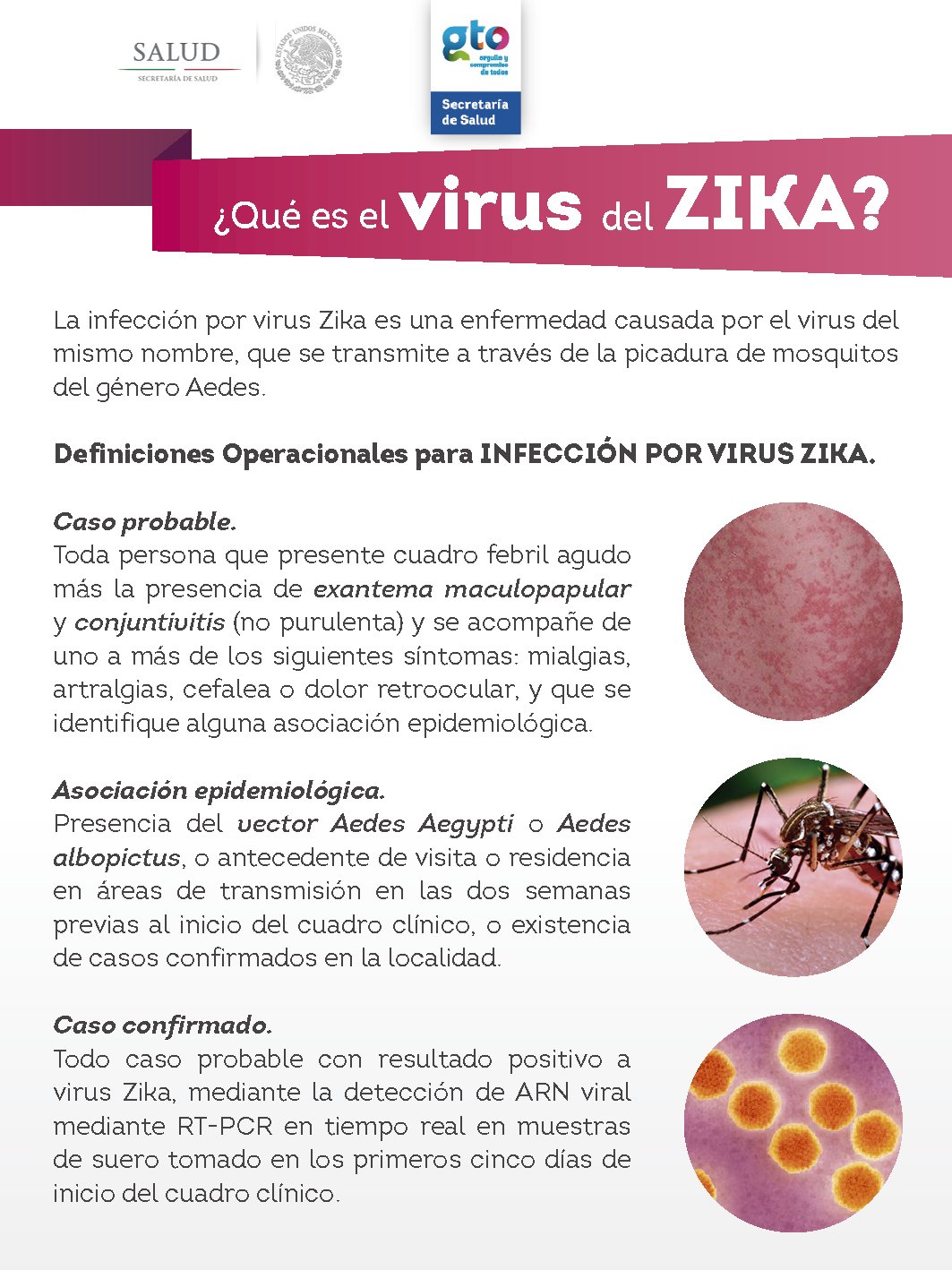 ¿Qué Es El Zika? 5 Cosas Que Debes Saber Sobre El Virus – ZPUZN