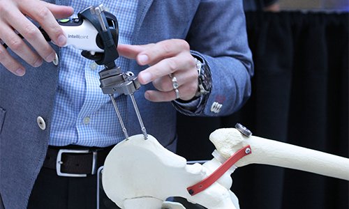 Home » Intellijoint Surgical