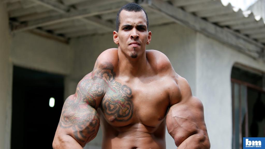 Meet the real-life Hulk with 20 INCH arms.. who has finally beat his ...