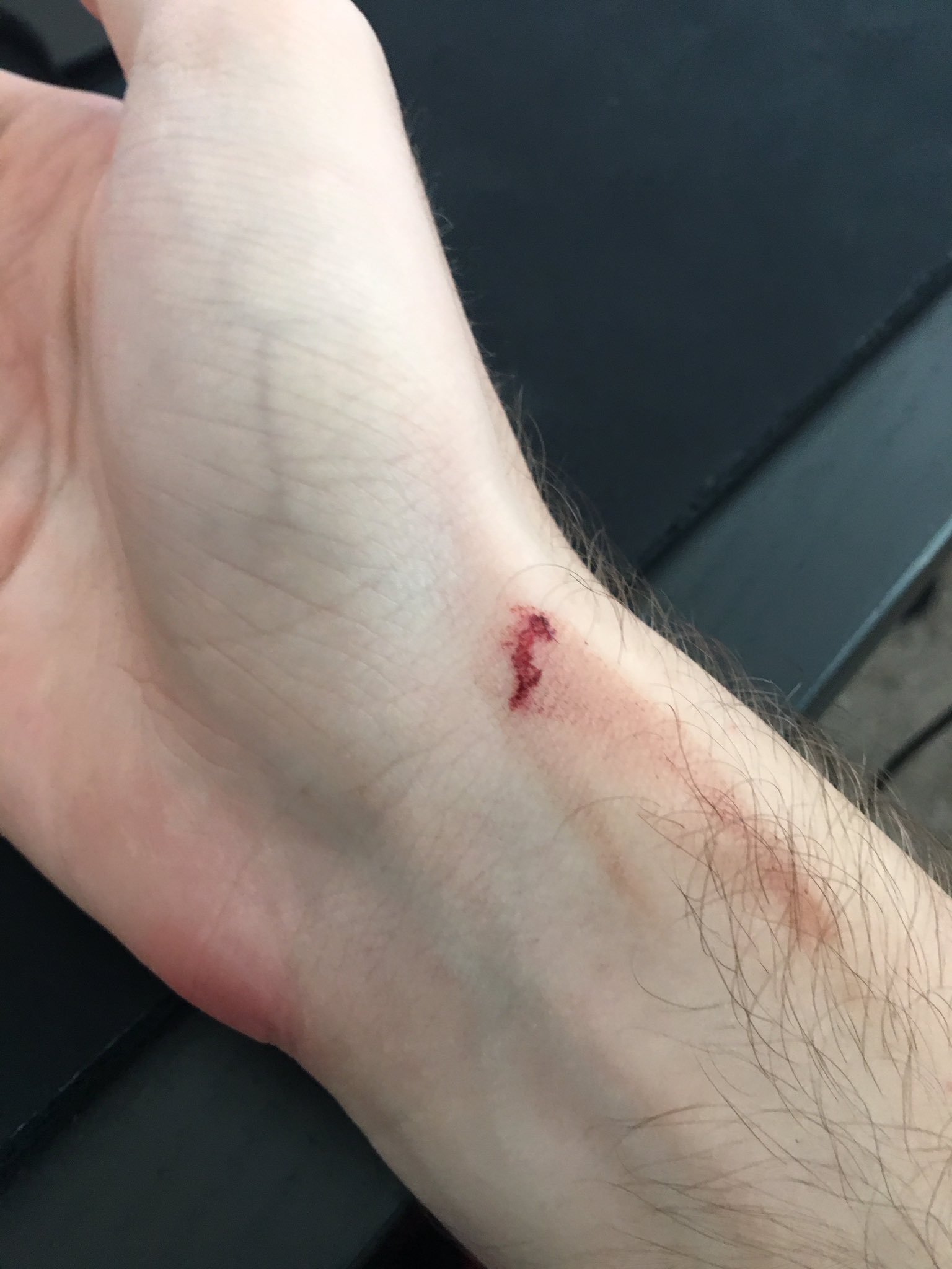 Wrist Cut In Love