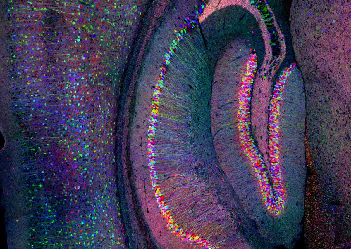 Brainbow Hippocampus