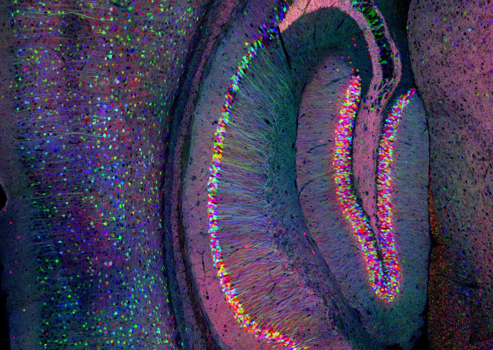 Brainbow Hippocampus