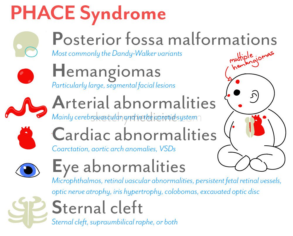 Radiologyspirit Phaces Syndrome - vrogue.co
