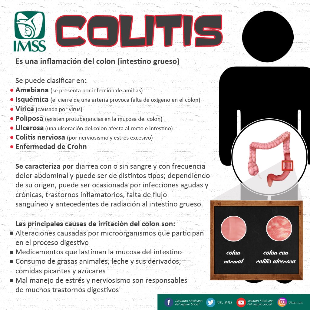 SabíasQue la colitis es una inflamación del colon (intestino grueso ...