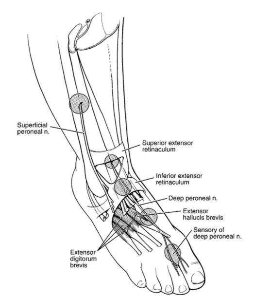 Anatomía Del Nervio Peroneo Superficial