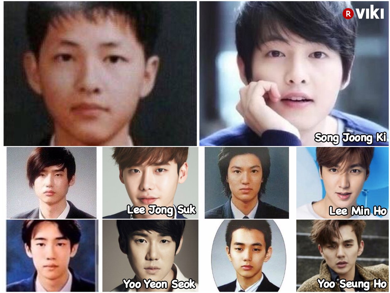 Lee Jong Suk Before After