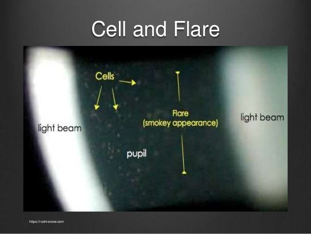 Anterior Chamber Cell