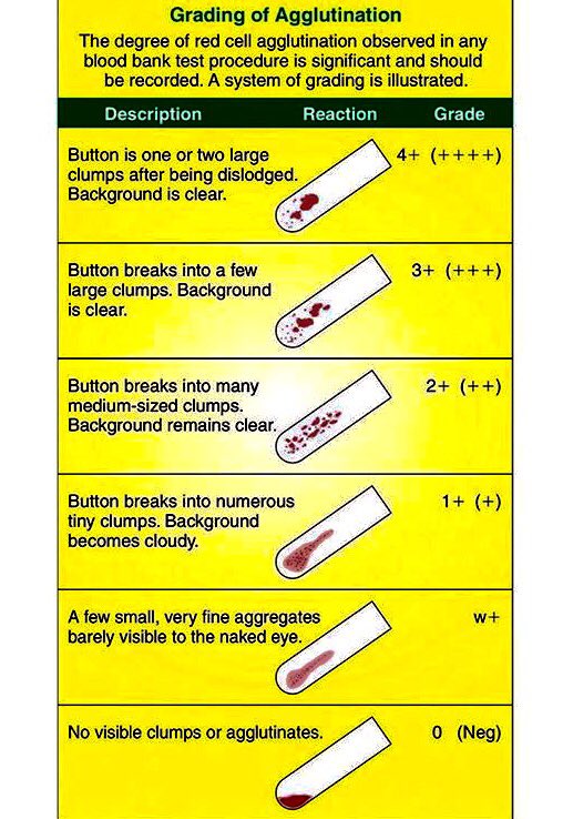 Rbc Agglutination Test