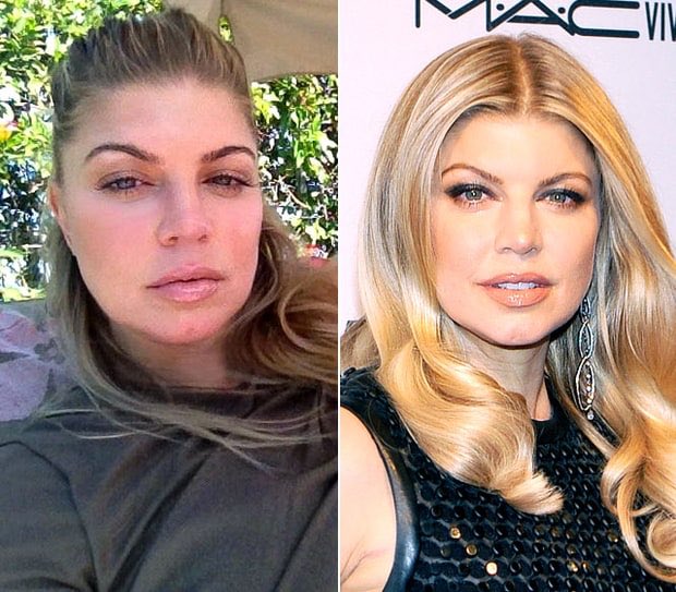 Fergie Before And After Face