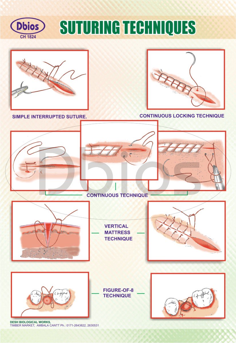 Different Types Of Surgical Suturing MEDizzy, 46% OFF