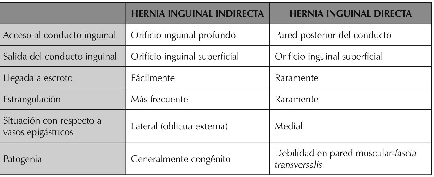 Hernia Directa Vs Indirecta